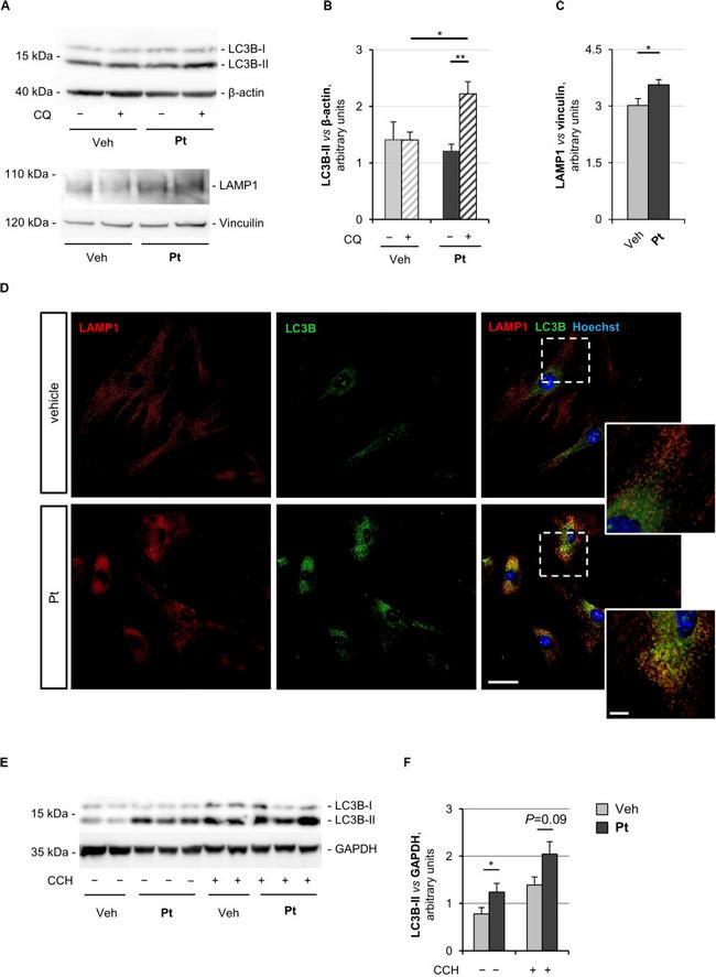 LC3B Antibody (PA1-16930)
