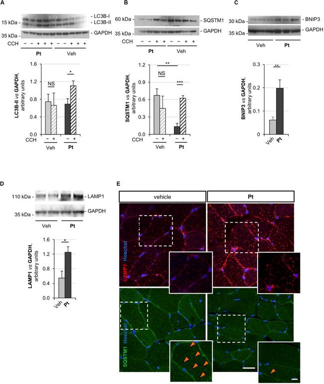 LC3B Antibody (PA1-16930)