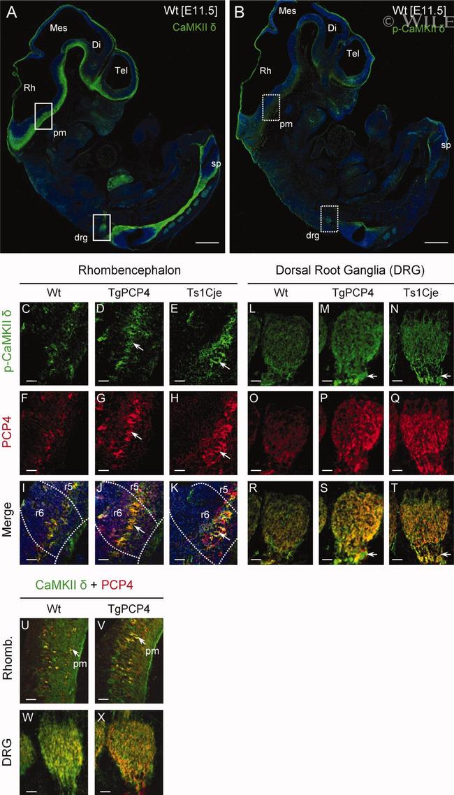 Phospho-CaMKII alpha (Thr286) Antibody (MA1-047)