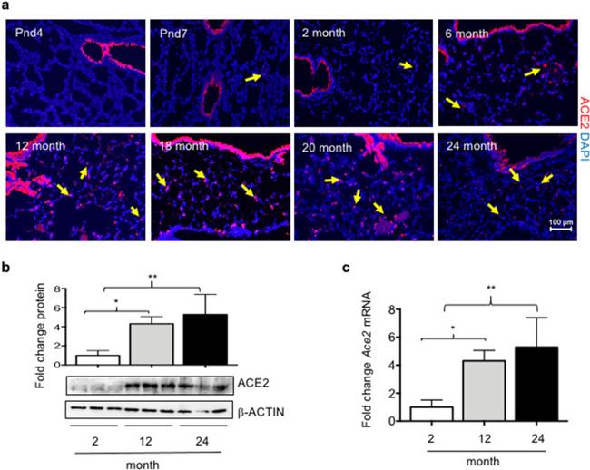 ACE2 Antibody (PA5-47488)