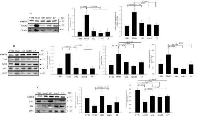 ATGL Antibody (MA5-14990)