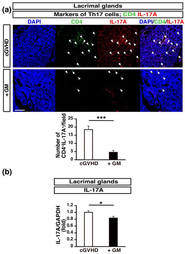 IL-17A Antibody, Biotin (13-7177-81)