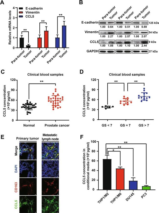 CD163 Antibody (14-1639-82)