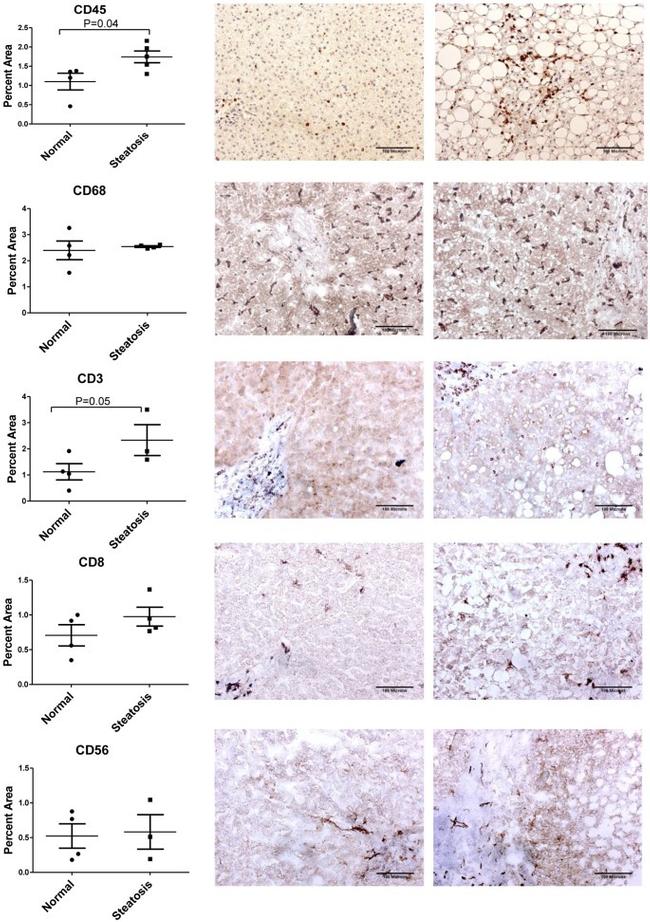 CD68 Antibody, Alexa Fluor™ 647 (51-0689-42)
