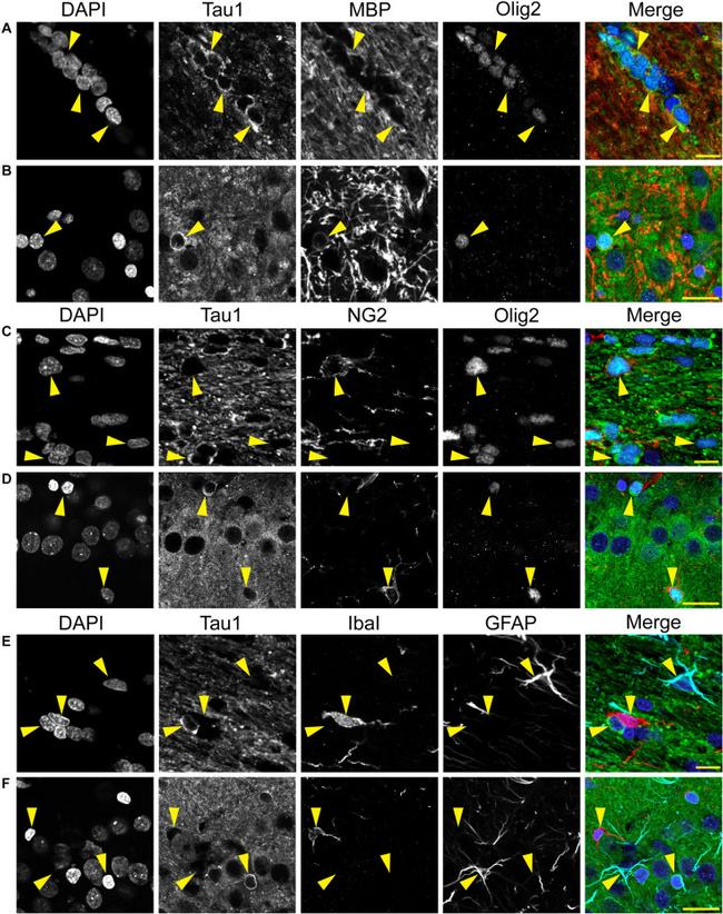 MBP Monoclonal Antibody (MBP101) (MA1-10837)