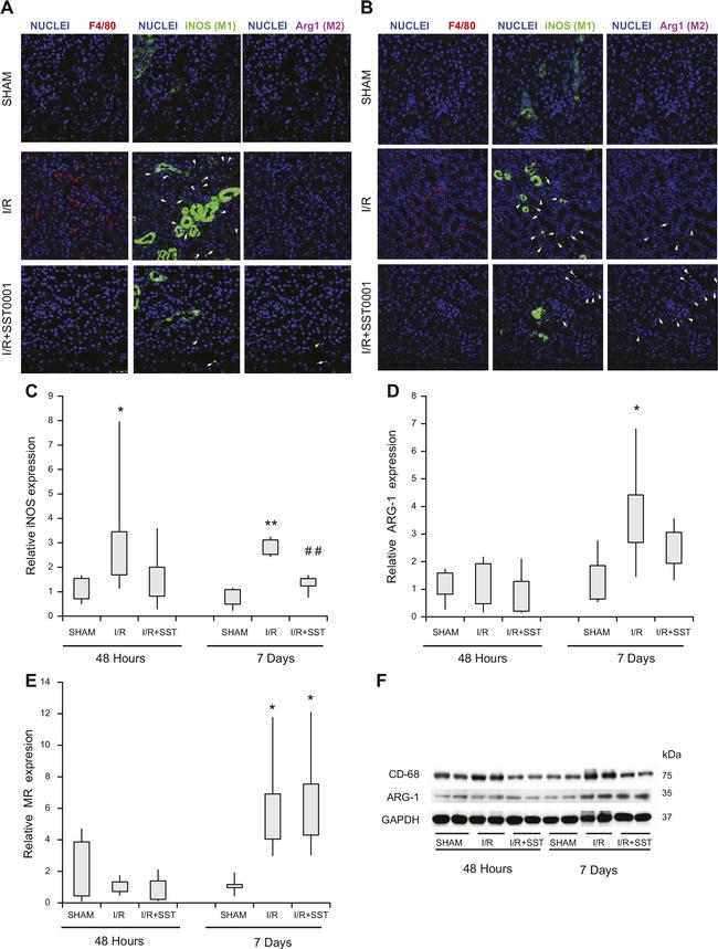 CD68 Antibody (14-0681-82)