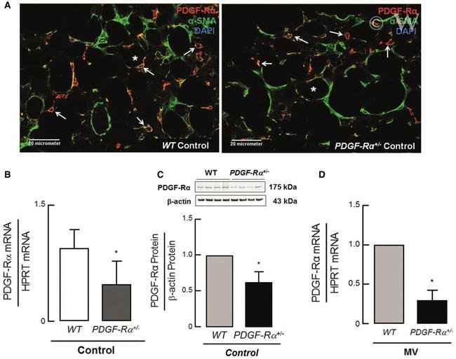 CD140a (PDGFRA) Antibody (14-1401-82)