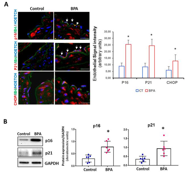p21 (WAF1, Cip1) Antibody (14-6715-81)