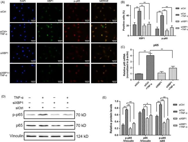 XBP1 Antibody (MA5-15768)