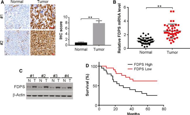 FDPS Antibody (PA5-28228)
