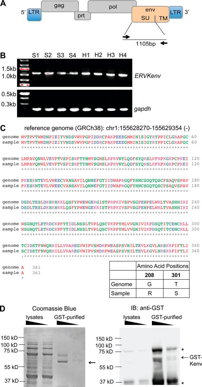 GST Tag Antibody (CAB4169)
