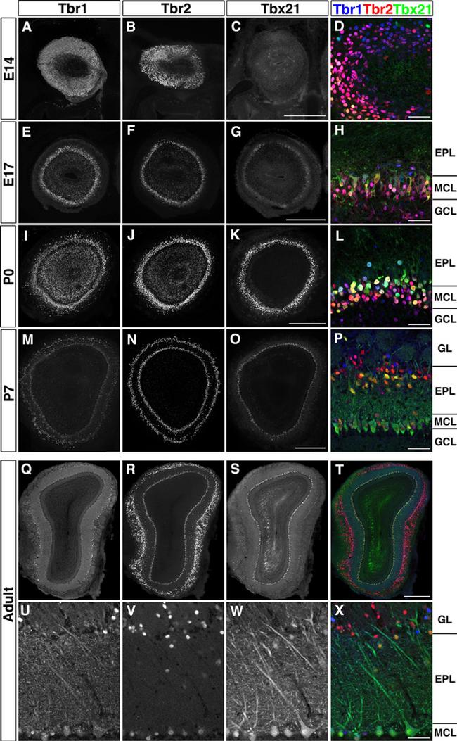 EOMES Antibody (14-4875-82)