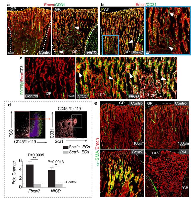 CD140b (PDGFRB) Antibody (14-1402-82)