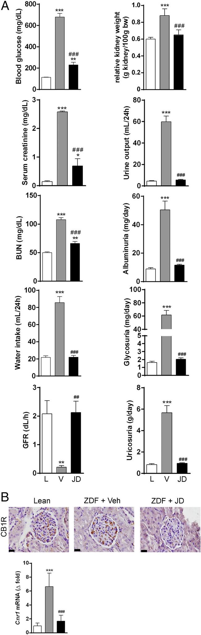 Cannabinoid Receptor 1 Antibody (PA1-743)