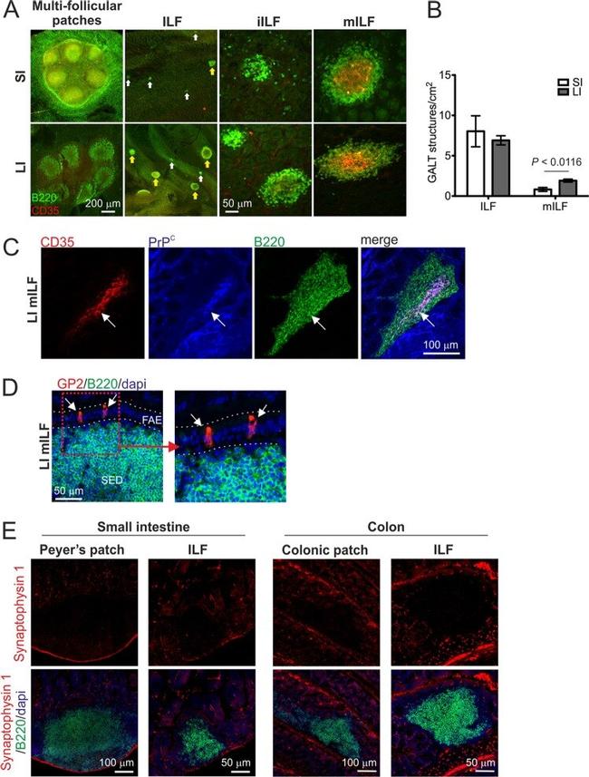 CD45R Antibody (MA1-70098)