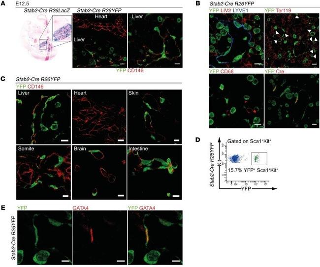 CD117 (c-Kit) Antibody (14-1172-82)