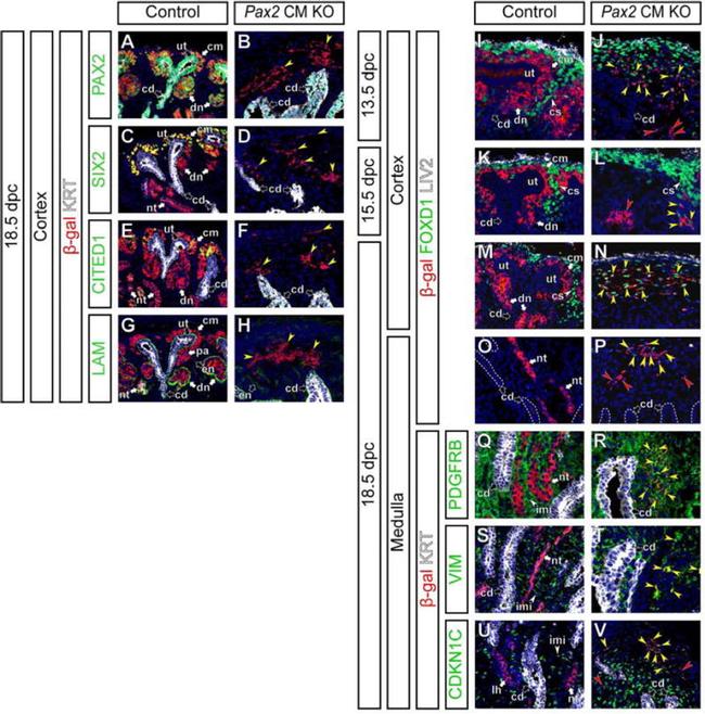 CD140b (PDGFRB) Antibody (14-1402-82)