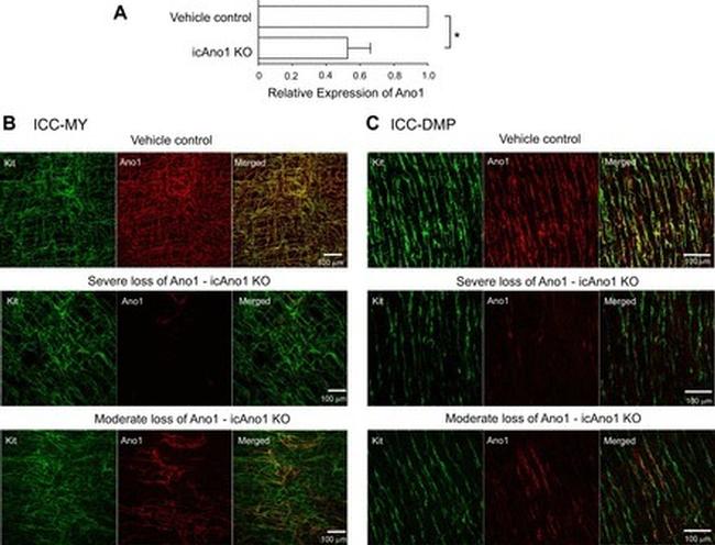 CD117 (c-Kit) Antibody (14-1172-82)
