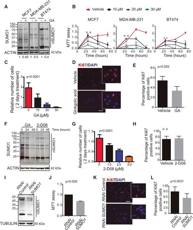 Ki-67 Antibody (PA1-21520)
