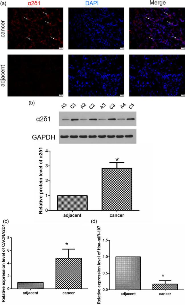CACNA2D1 Antibody (MA3-921)