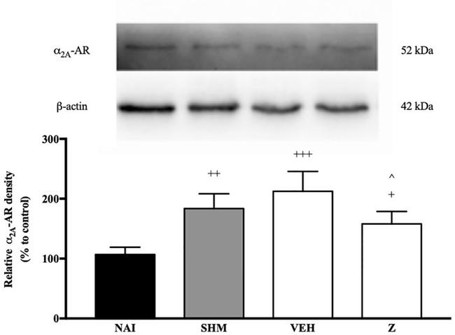 alpha-2a Adrenergic Receptor Antibody (PA1-048)