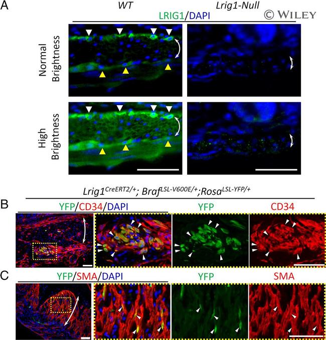 CD34 Antibody, eFluor™ 450 (48-0341-82)