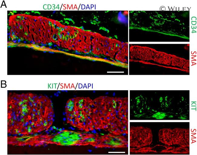 CD34 Antibody, eFluor™ 450 (48-0341-82)