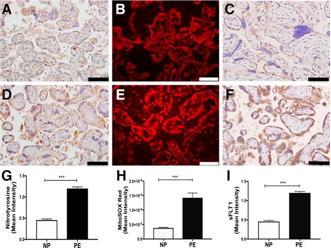 Nitrotyrosine Antibody (A-21285)