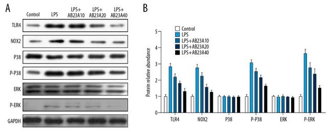 NOX2 Antibody (MA5-18052)