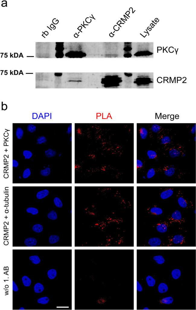 alpha Tubulin Antibody, Alexa Fluor™ 488 (53-4502-82)