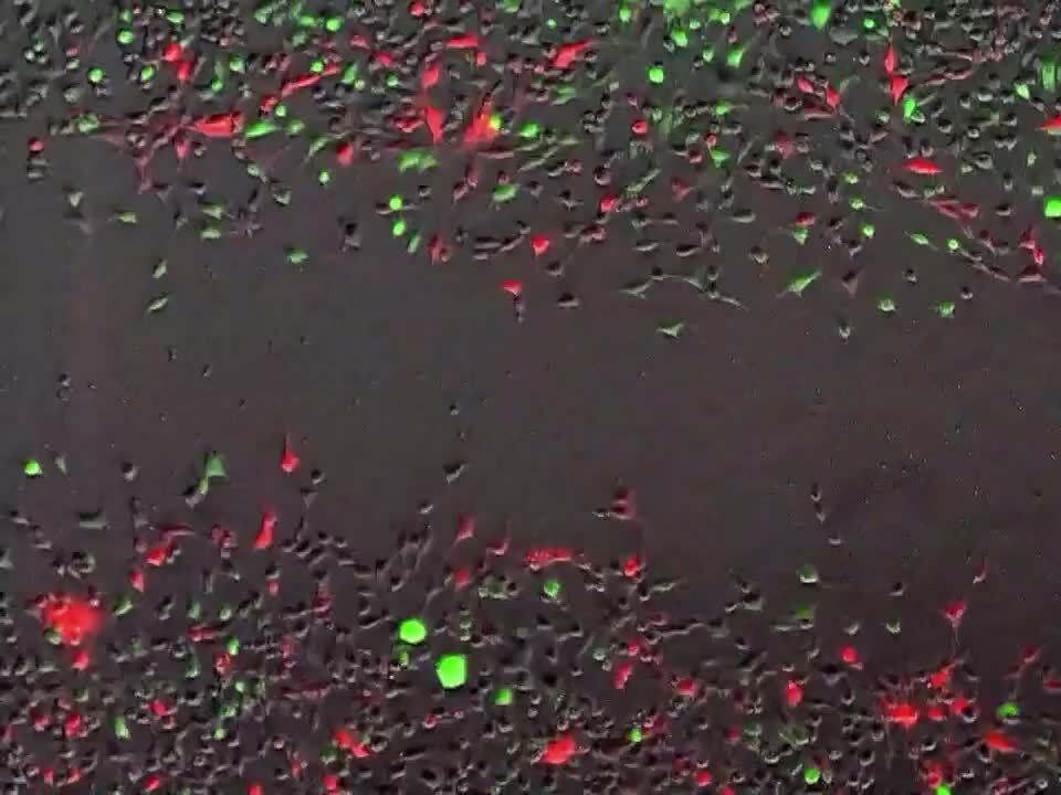 EVOS倒置荧光显微镜的用途和功能-赛默飞 | Thermo Fisher Scientific - CN