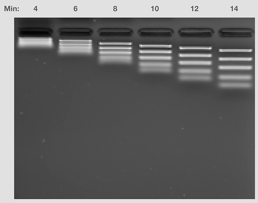 Steps in Nucleic Acid Gel Electrophoresis | Thermo Fisher Scientific - BR