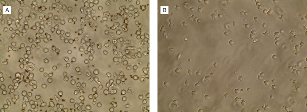 Cell Culture Quality Control During T Cell Expansion | Thermo Fisher ...