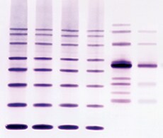 Blocking Buffers for Western Blotting | Thermo Fisher Scientific - CN