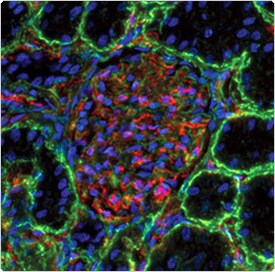Qdot Probes Technology Overview | Thermo Fisher Scientific - CN
