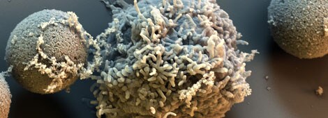 Dynabeads 磁性分离技术 | Thermo Fisher Scientific - CN