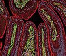 Zymed | Thermo Fisher Scientific - CN