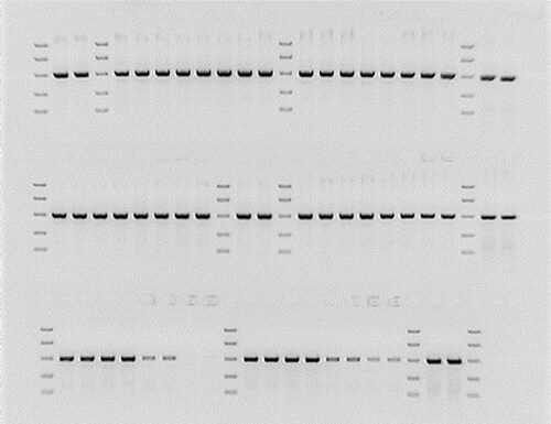 Eight Tips to Improve Gel Electrophoresis Results | Thermo Fisher ...