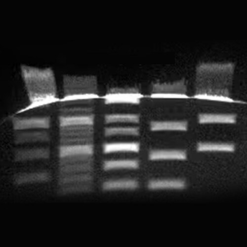 Eight Tips to Improve Gel Electrophoresis Results | Thermo Fisher ...