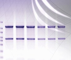 RNA Electrophoresis—Thermo Scientific | Thermo Fisher Scientific - CN