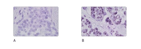CISH | Thermo Fisher Scientific - CN