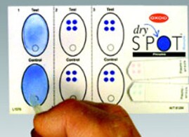 Latex Agglutination Identification | Thermo Fisher Scientific - CN
