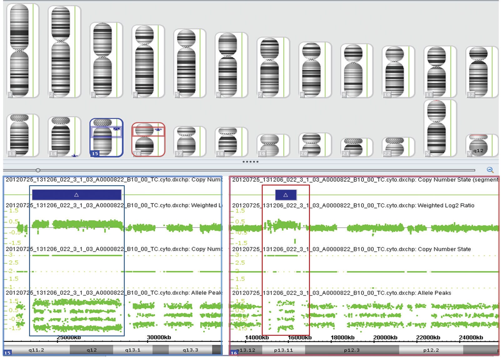 发育迟缓和智力障碍检测-赛默飞 | Thermo Fisher Scientific - CN