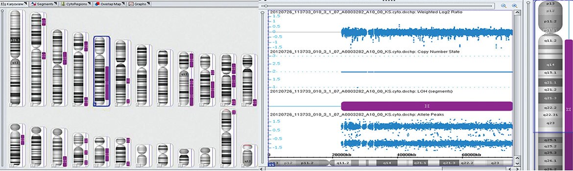 Developmental Delay & Intellectual Disability Testing | Thermo Fisher ...