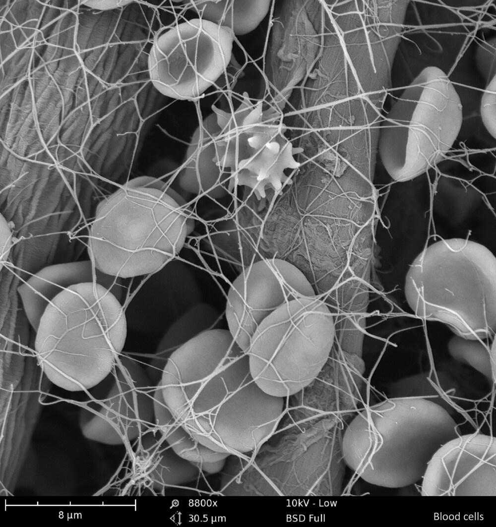 Desktop SEM | Phenom XL G2 | Thermo Fisher Scientific - CN