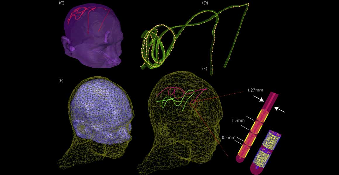 Amira Software for Neuroimaging | Thermo Fisher Scientific - CN