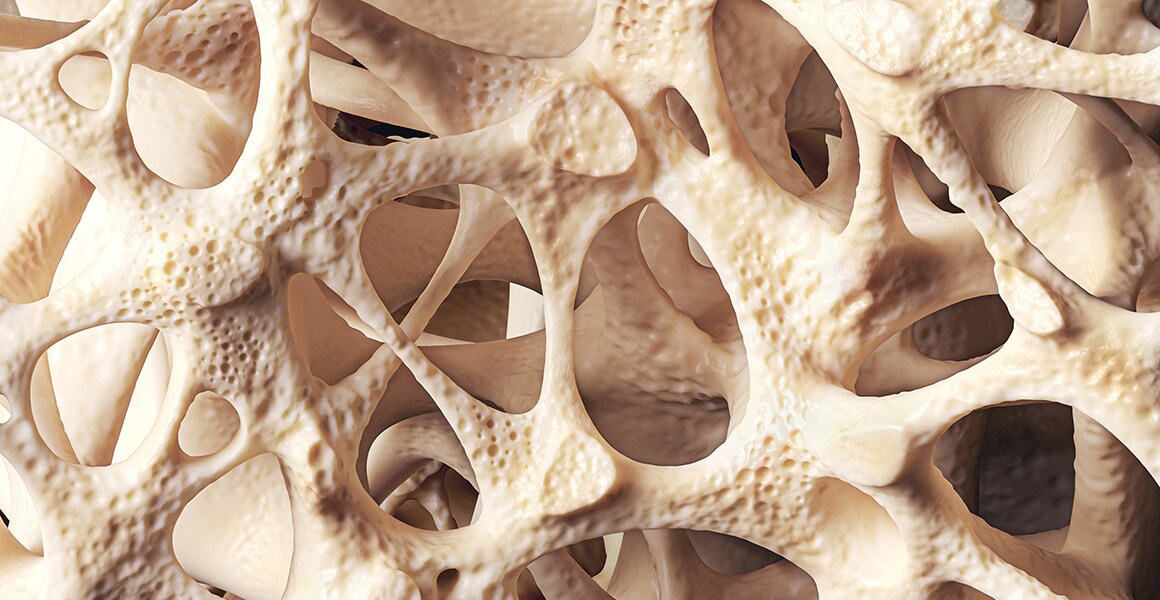 Avizo Software for meshing and FEA simulation | Thermo Fisher ...