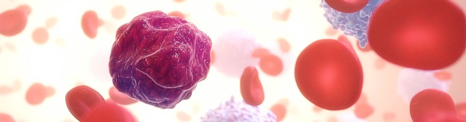 On-demand webinar: NGS for Myeloid MRD Detection | Thermo Fisher ...