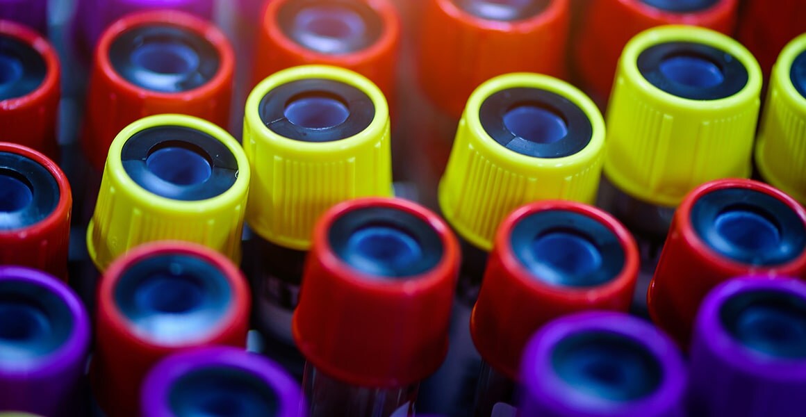 Benefits of HPLC-CAD Analysis | Thermo Fisher Scientific - CN