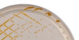 General Prepared Media Plates | Thermo Fisher Scientific - CN